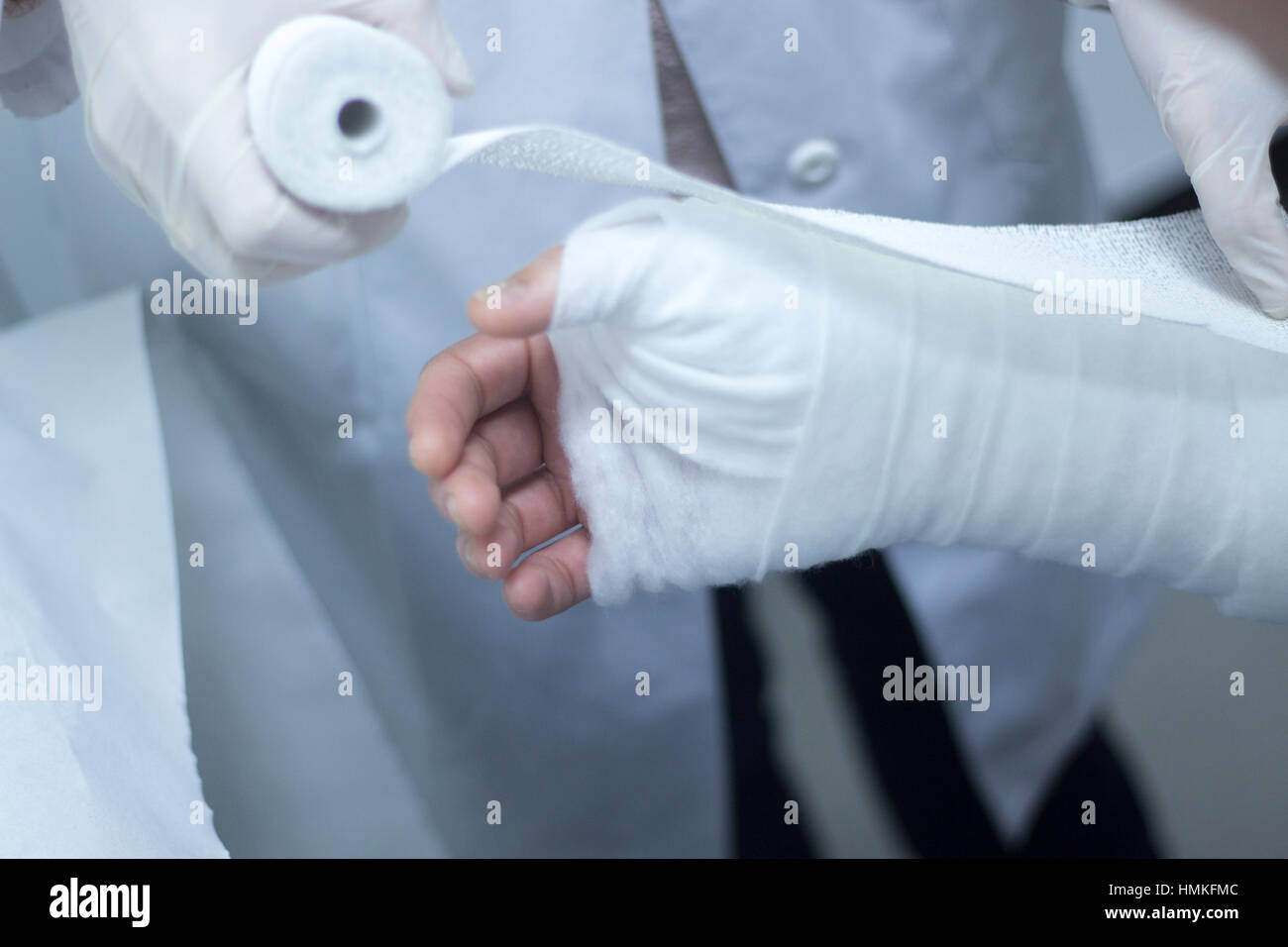 Doctor applying a plaster cast and bandages to patient forearm and ...