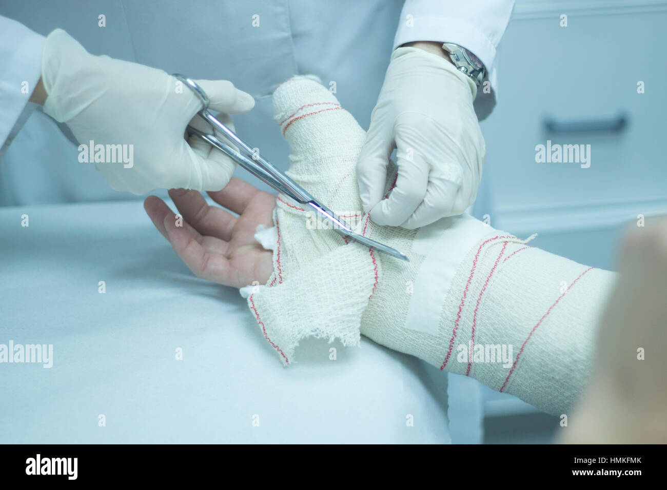 Hand Fracture Plaster Removal