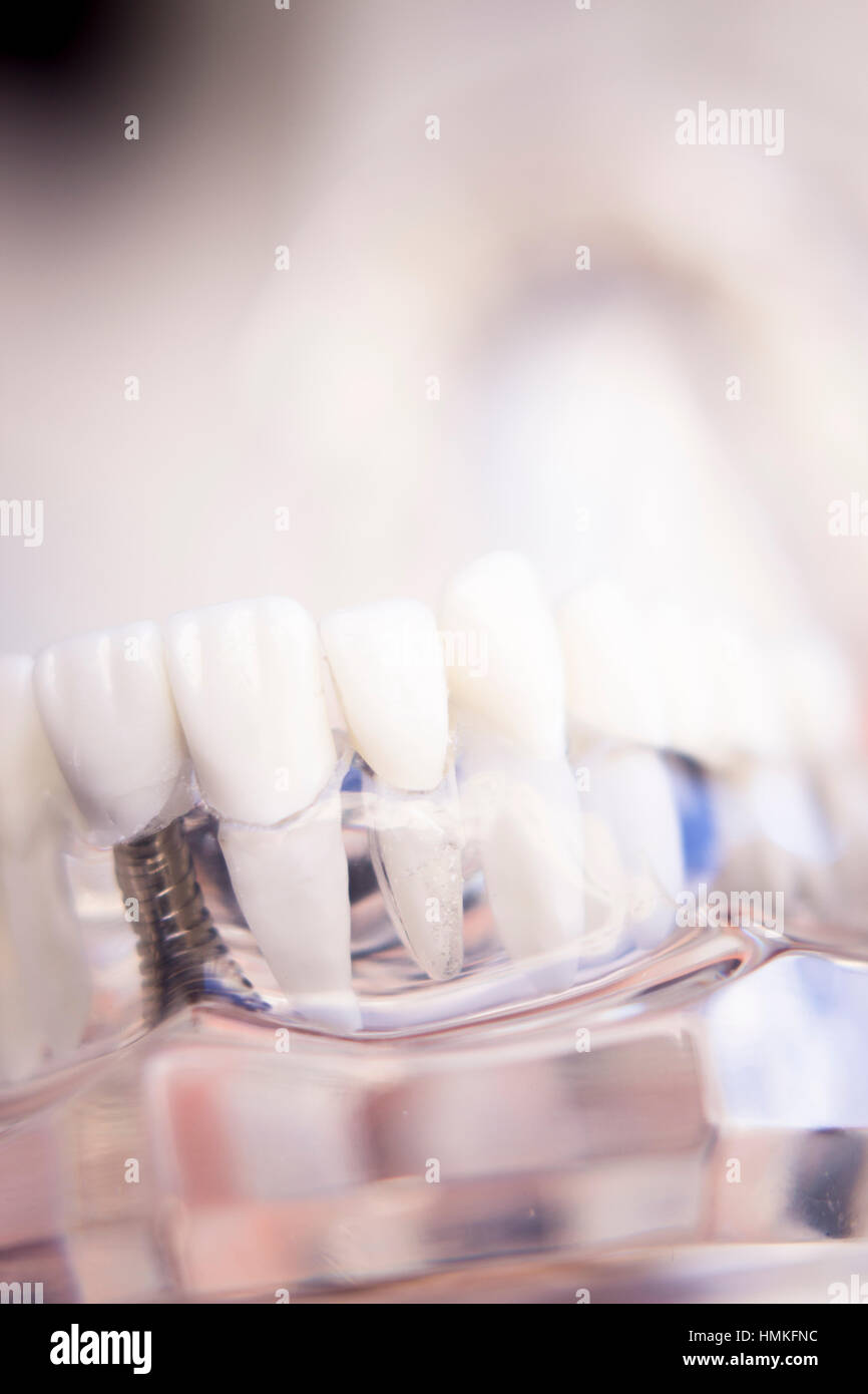 Dentists tooth plastic model used for teaching, learning and patient ...