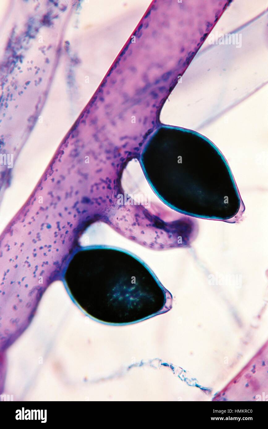 Filament with reproductive structures of Vaucheria sessilis ...