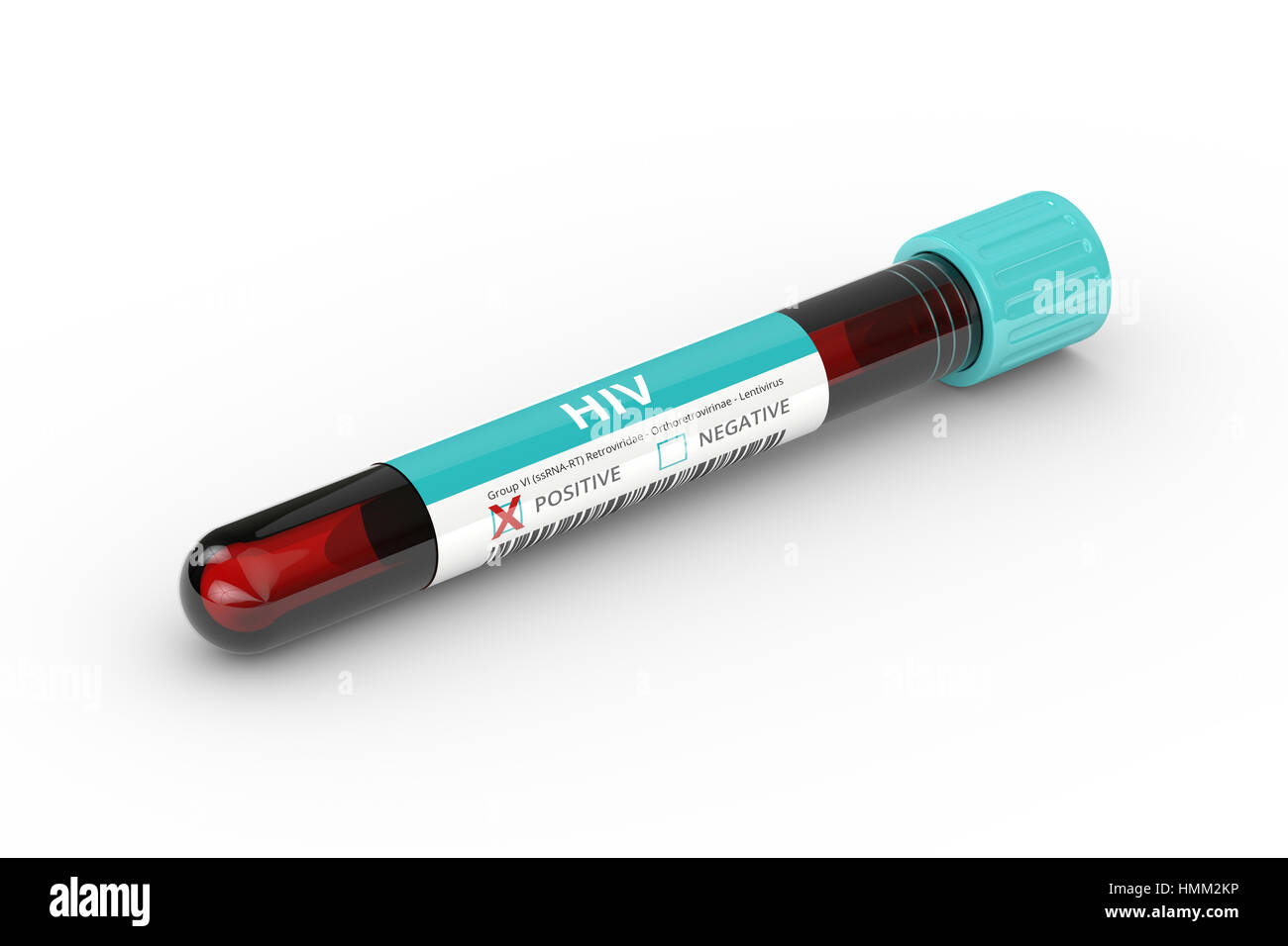 Positive hiv blood test hi-res stock photography and images - Alamy