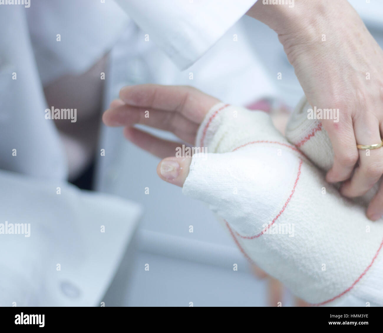 Doctor applying a plaster cast and bandages to patient forearm and ...