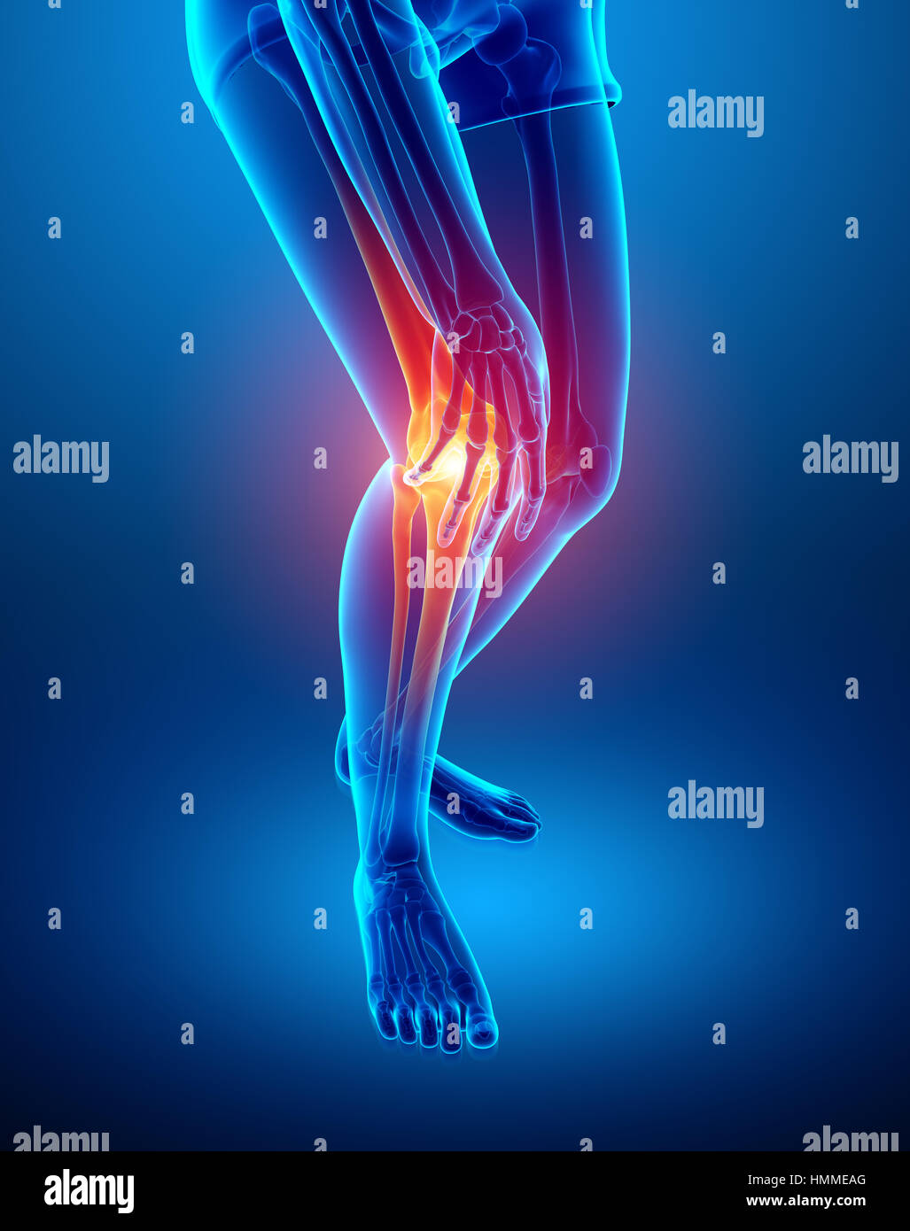 human body anatomy with joint pain Stock Photo - Alamy