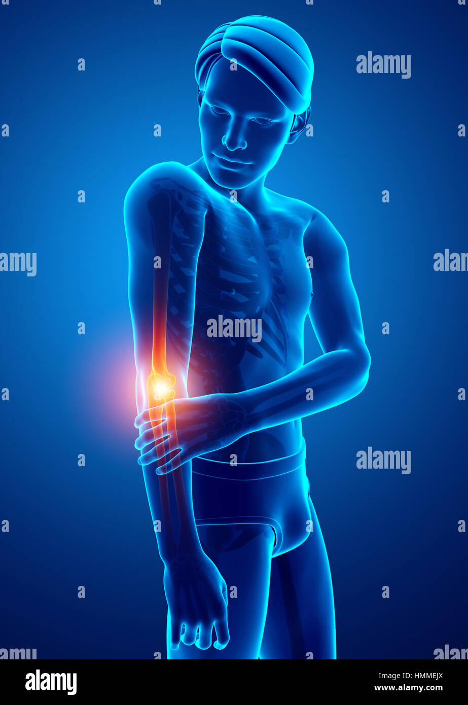 human body anatomy with joint pain Stock Photo - Alamy
