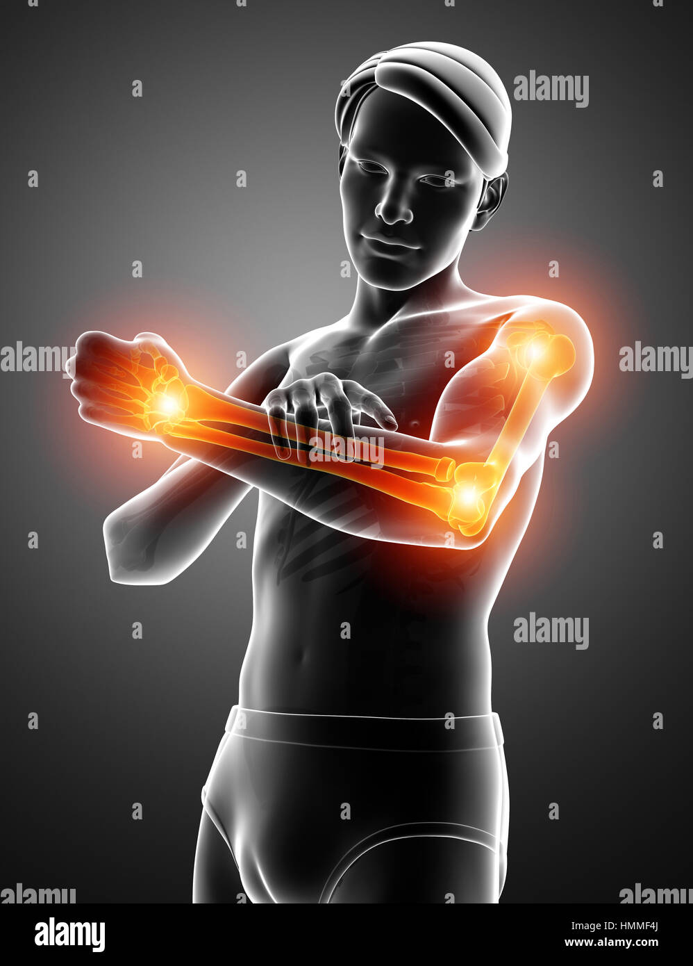 human body anatomy with joint pain Stock Photo - Alamy