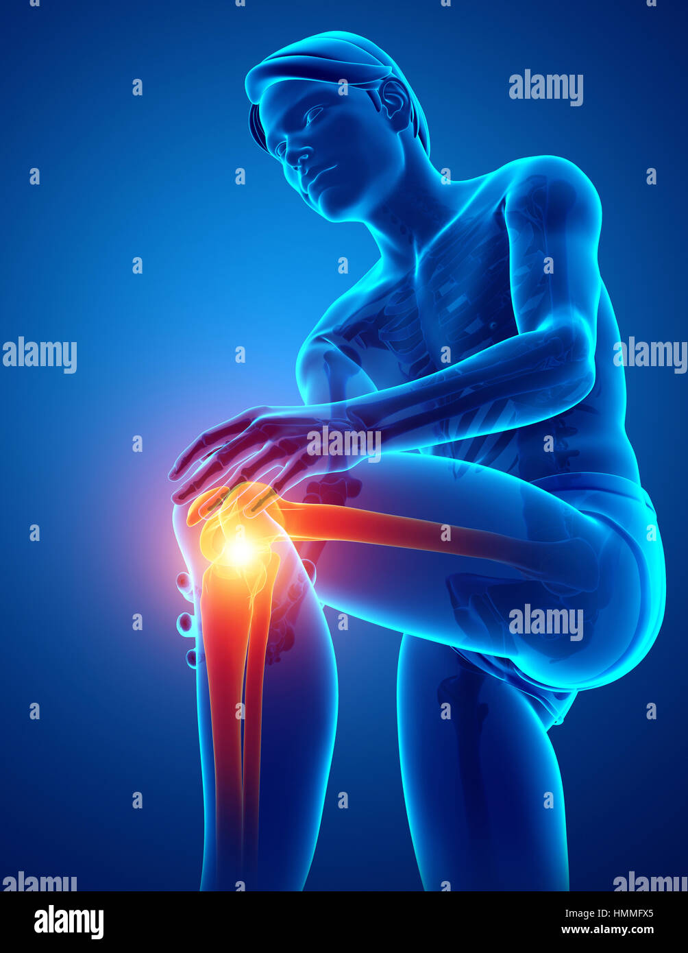human body anatomy with joint pain Stock Photo - Alamy