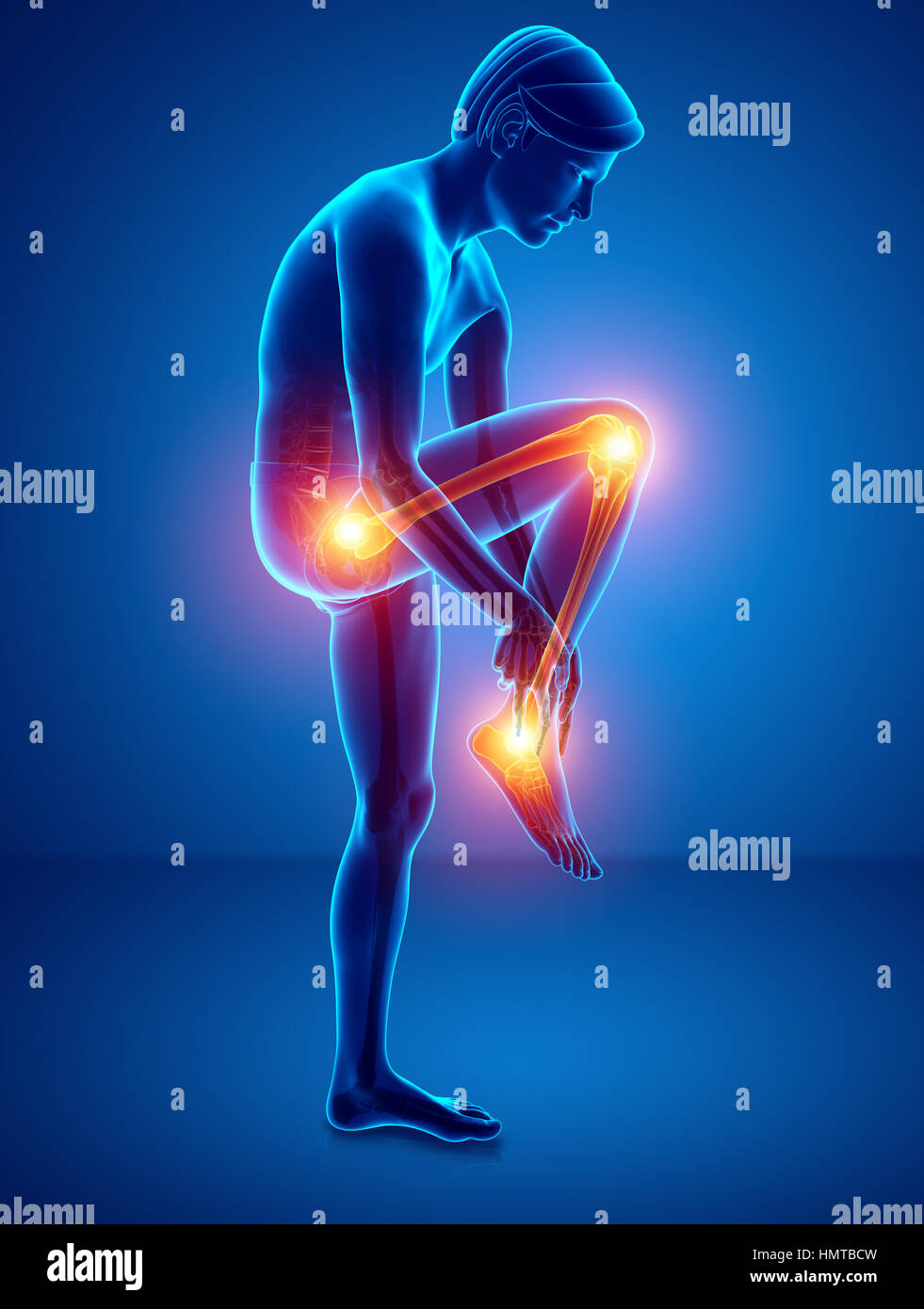 3d Illustration of Pain in leg Stock Photo - Alamy