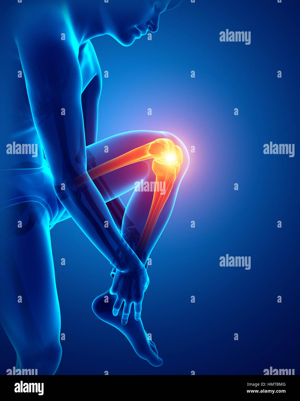 3d Illustration of Male Knee pain Stock Photo - Alamy
