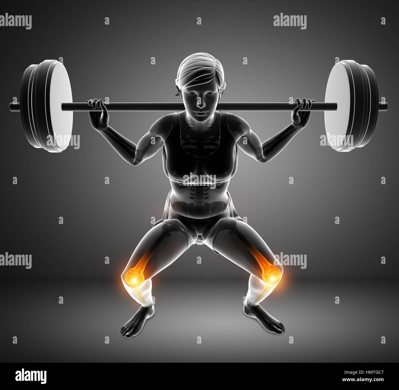 3d Illustration of Women Knee pain Stock Photo - Alamy