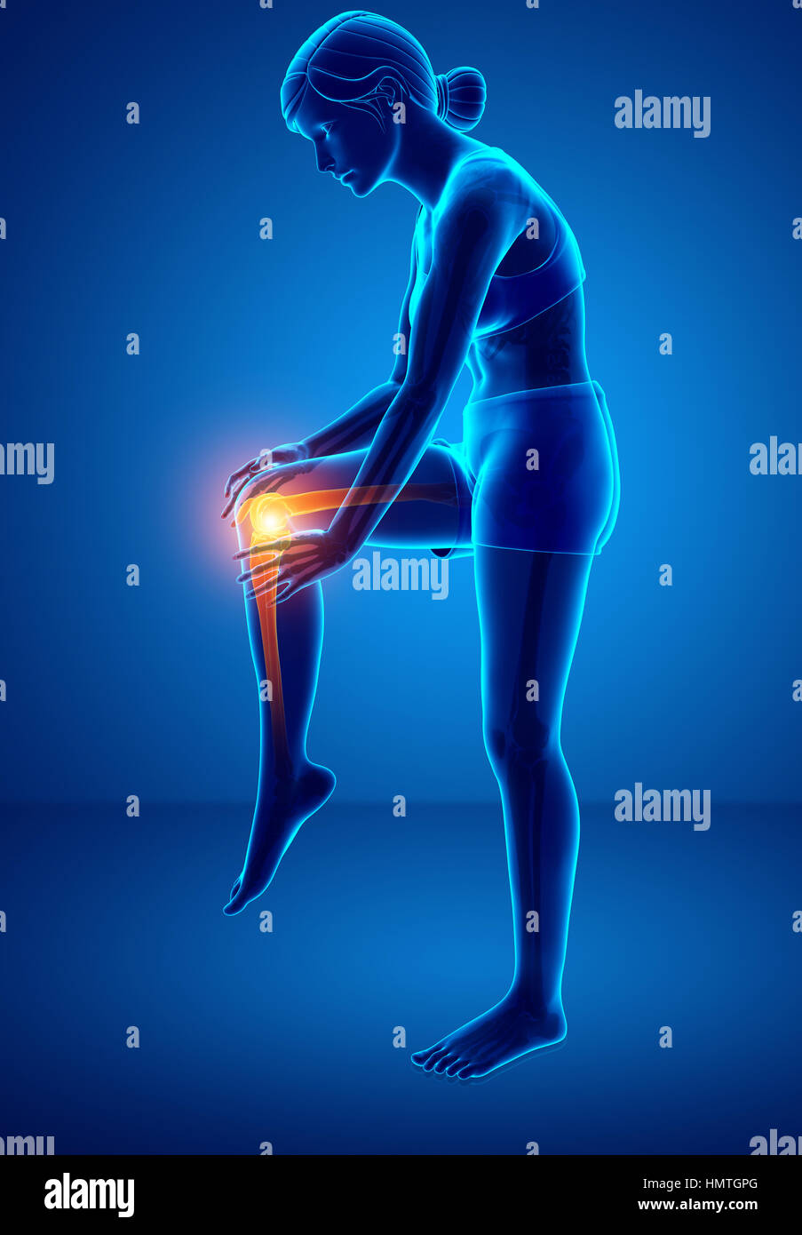 3d Illustration of Women Knee pain Stock Photo - Alamy