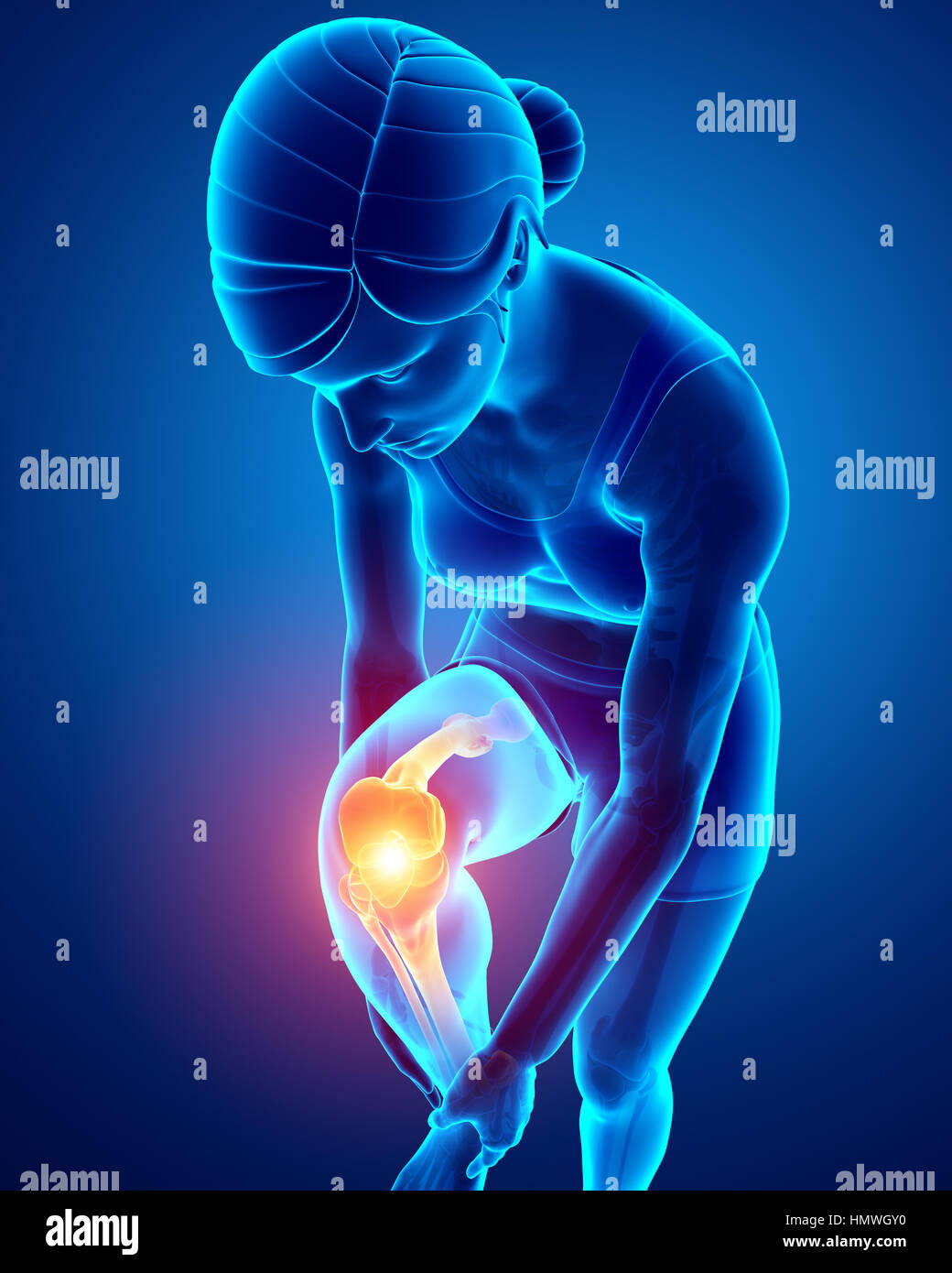 3d Illustration of Women Knee pain Stock Photo - Alamy