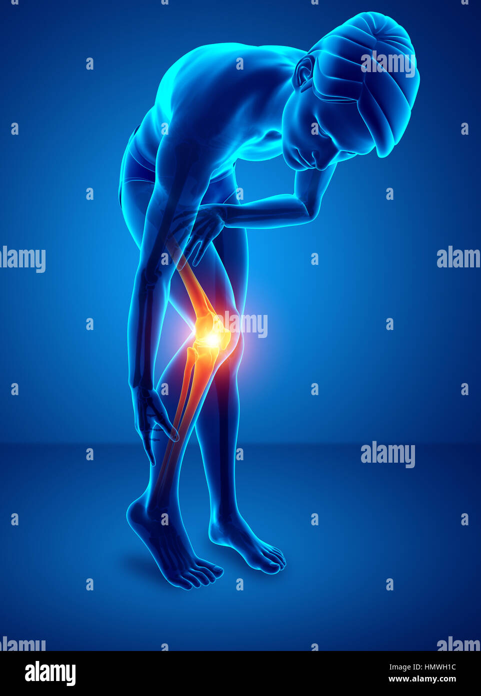 3d Illustration of Male Knee pain Stock Photo - Alamy