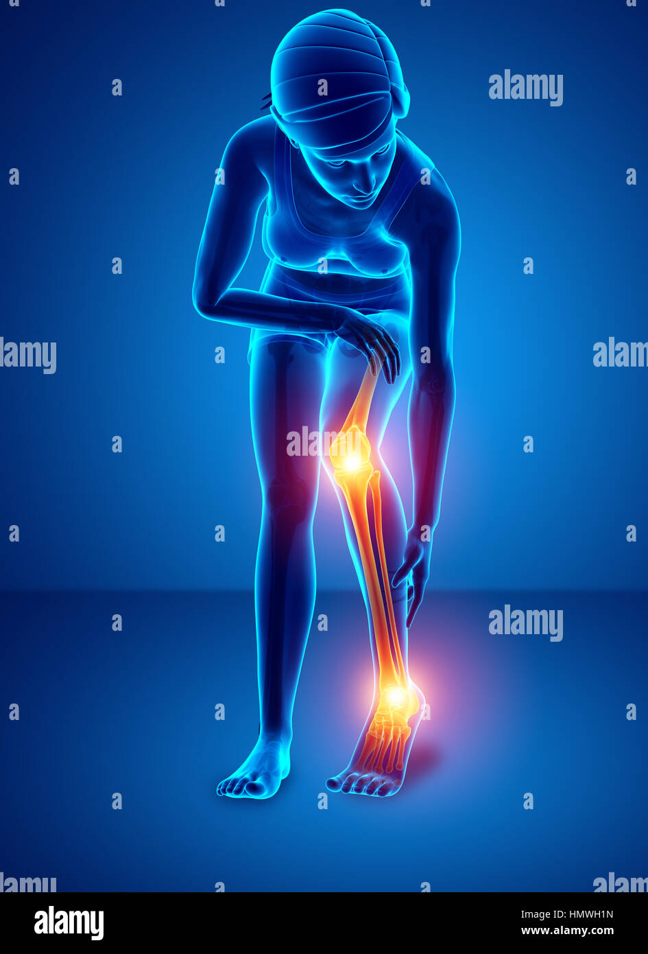 3d illustration of Pain in leg Stock Photo - Alamy