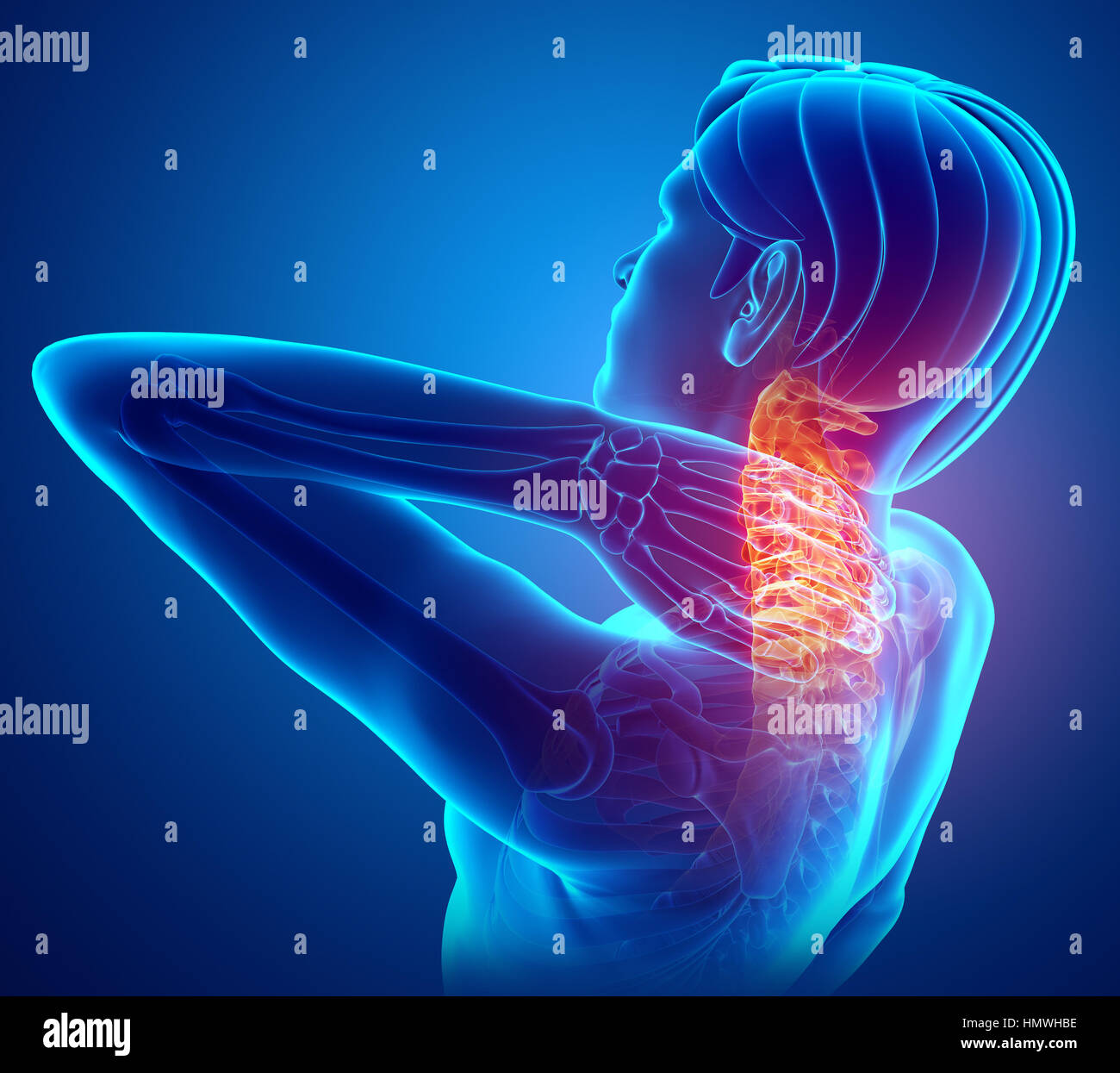 3d Illustration of men Feeling the Neck Pain Stock Photo - Alamy
