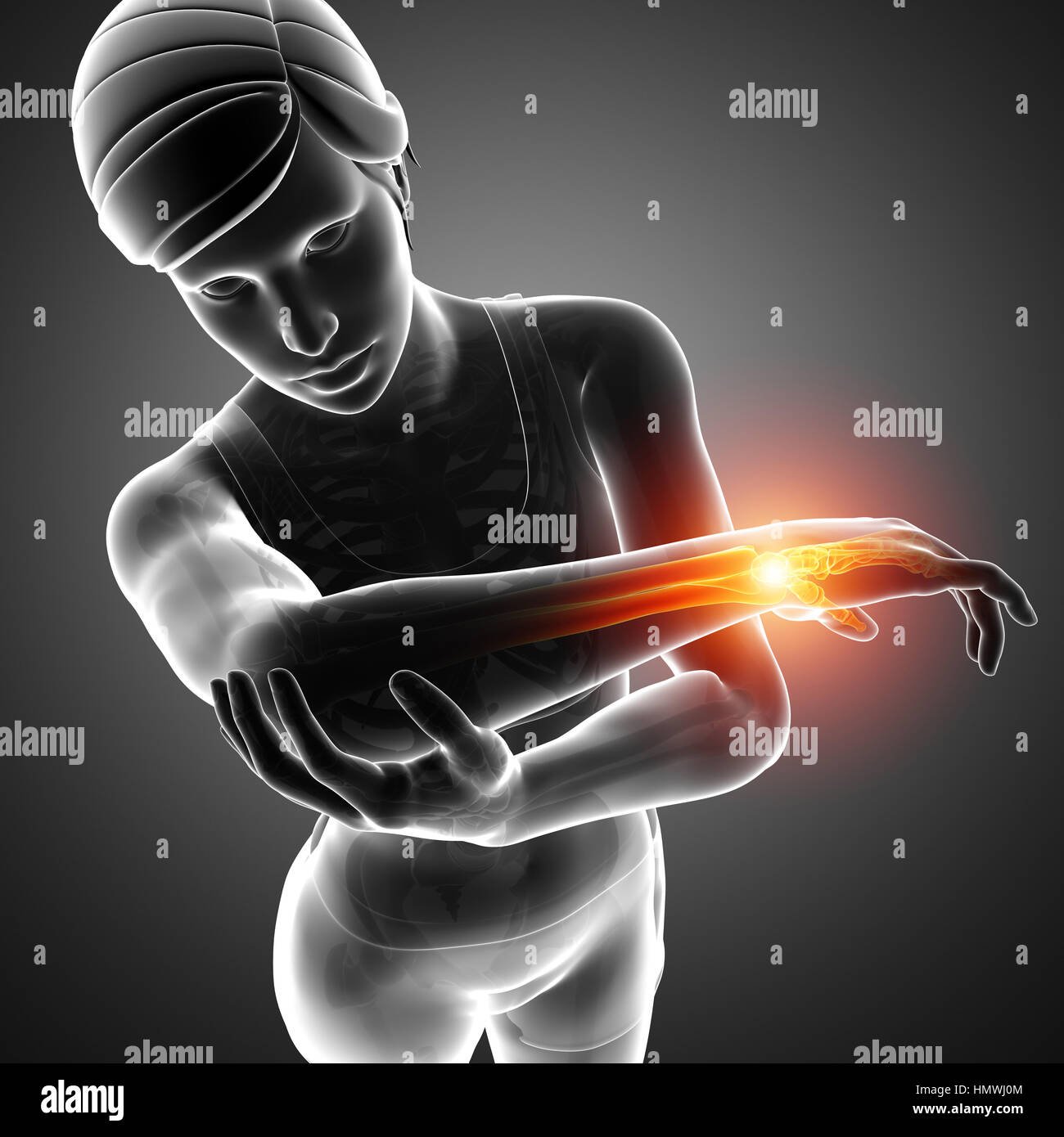 3d Illustration of Women Feeling the Wrist Pain Stock Photo - Alamy