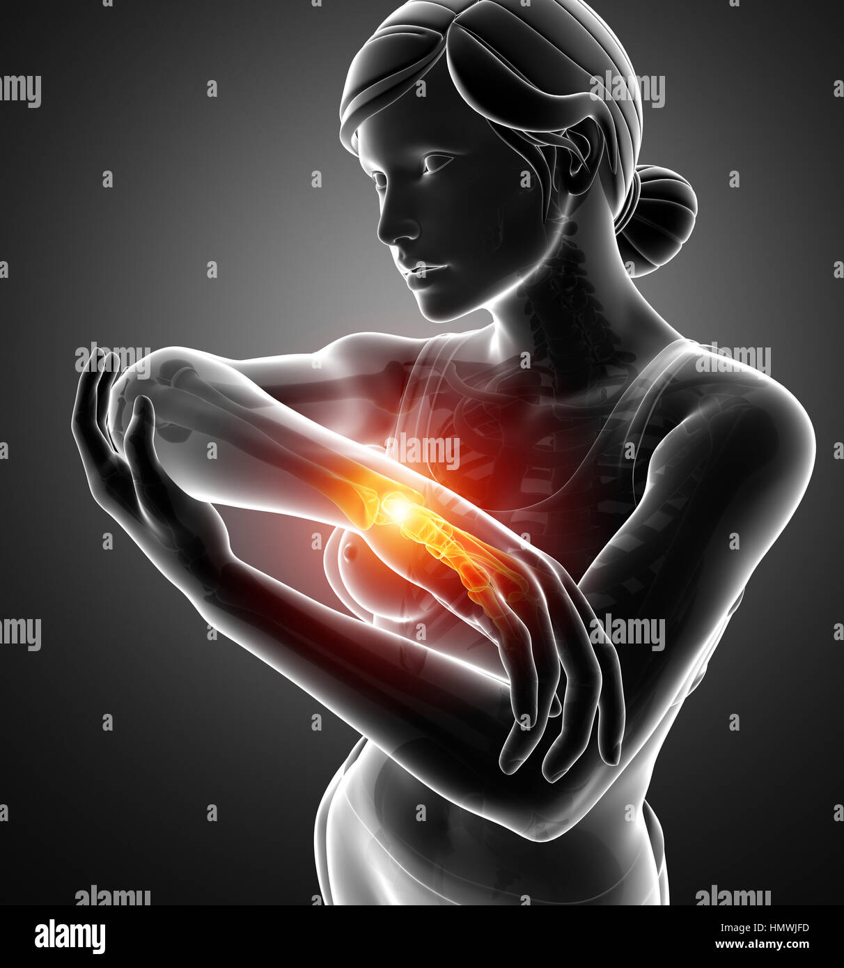 3d image of elbow joint hi-res stock photography and images - Alamy