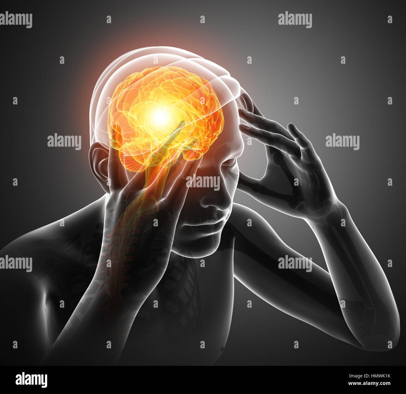 3d Illustration of Male Feeling Headache Stock Photo - Alamy