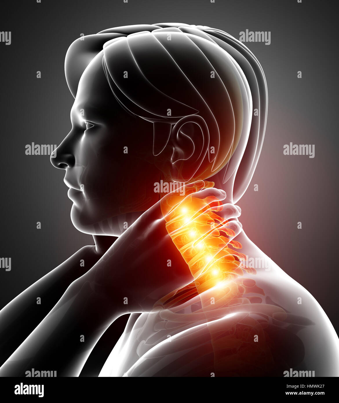 3d Illustration of men Feeling Neck Pain Stock Photo - Alamy