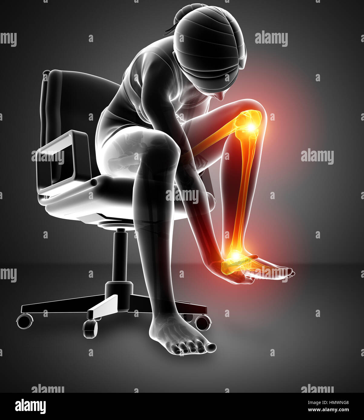 3d illustration of Pain in leg Stock Photo - Alamy