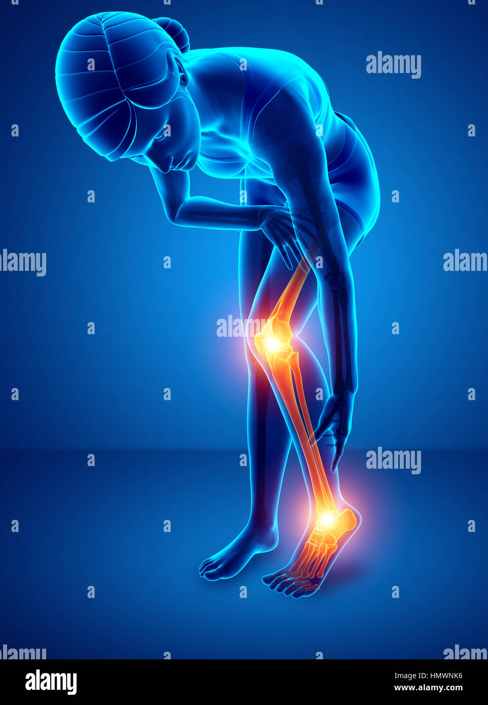 3d illustration of Pain in leg Stock Photo - Alamy