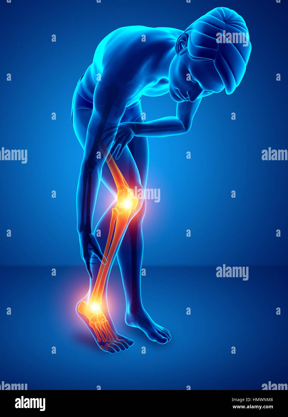 3d Illustration of Pain in leg Stock Photo - Alamy