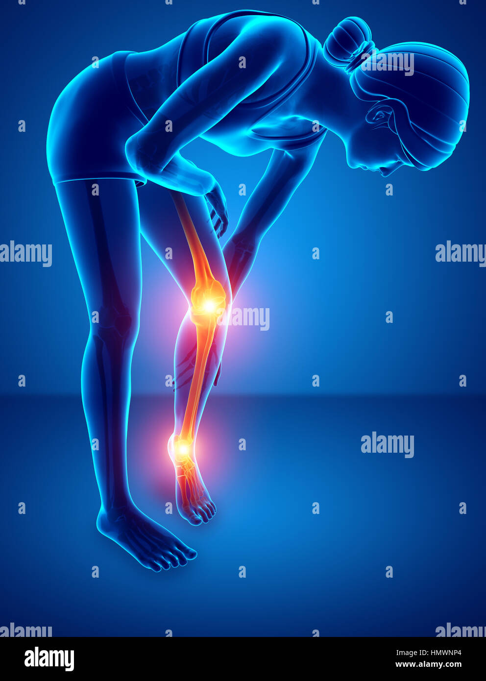 3d illustration of Pain in leg Stock Photo - Alamy