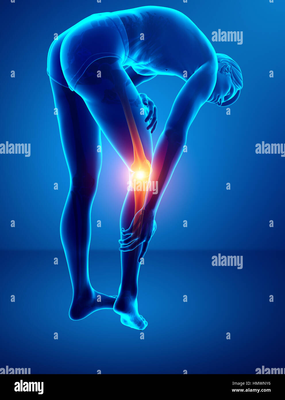 3d Illustration of Male Knee pain Stock Photo - Alamy