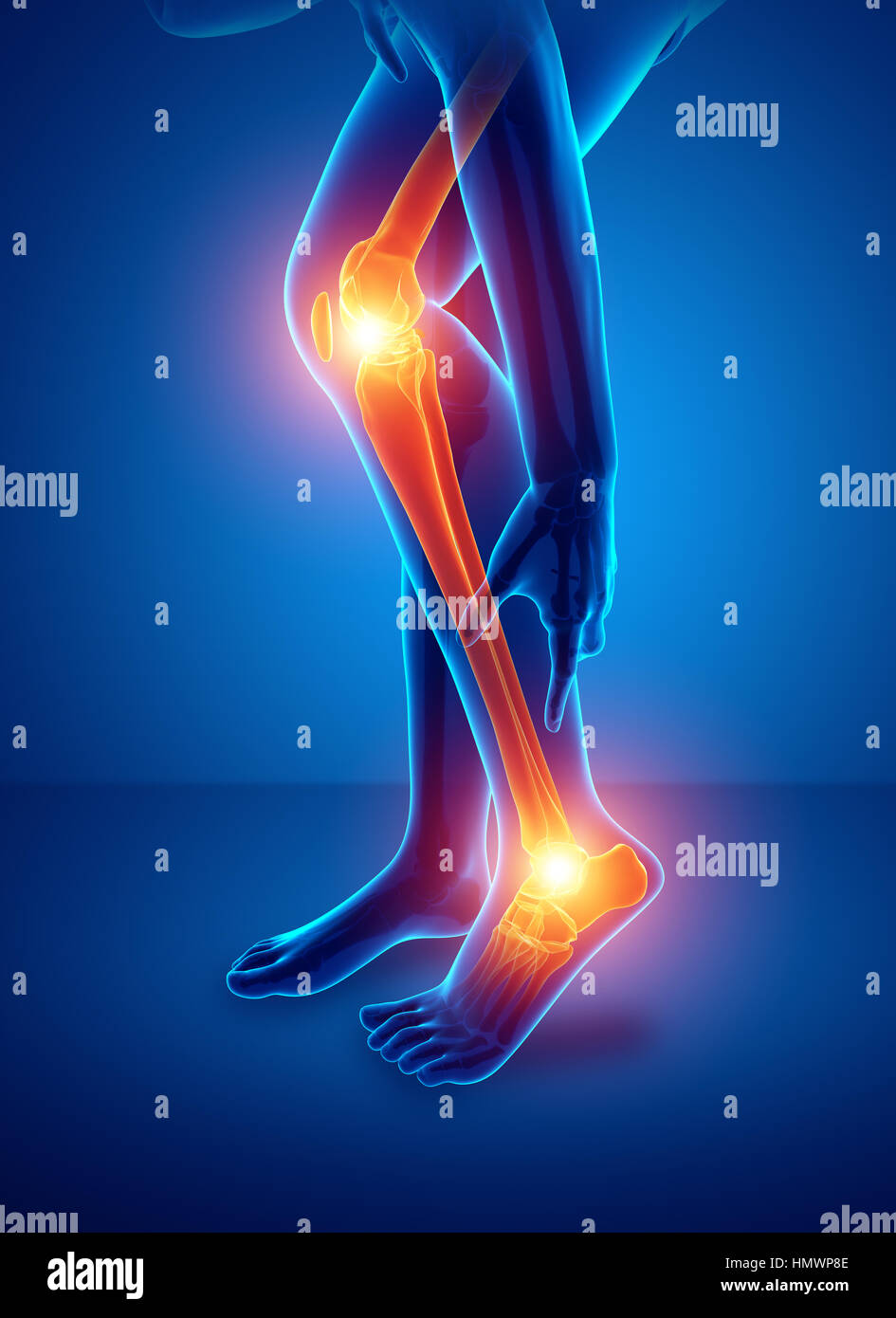 3d Illustration of Pain in leg Stock Photo - Alamy
