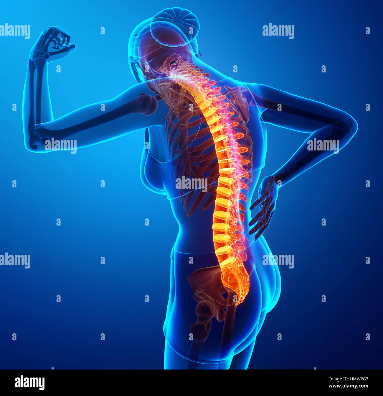 3d Illustration of Women Feeling the Back pain Stock Photo - Alamy