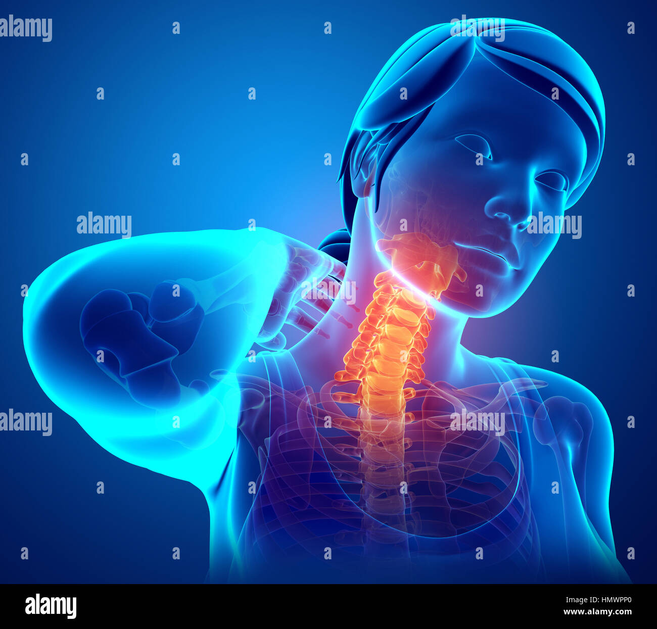 3d Illustration of Women Feeling the Neck Pain Stock Photo - Alamy