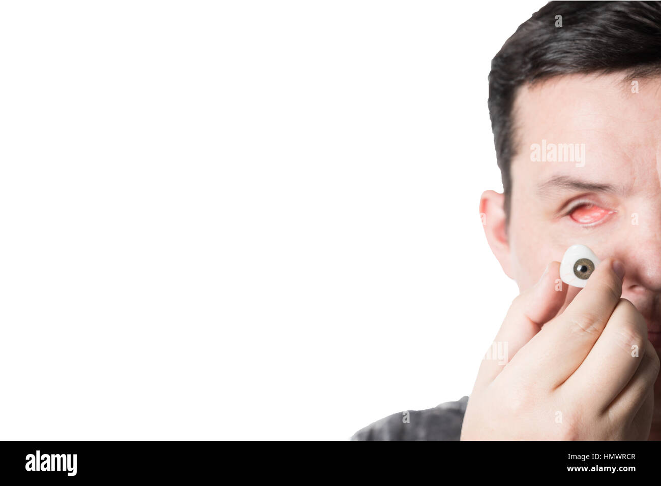 Glass eye prosthetic Ocular prosthesis Stock Photo - Alamy