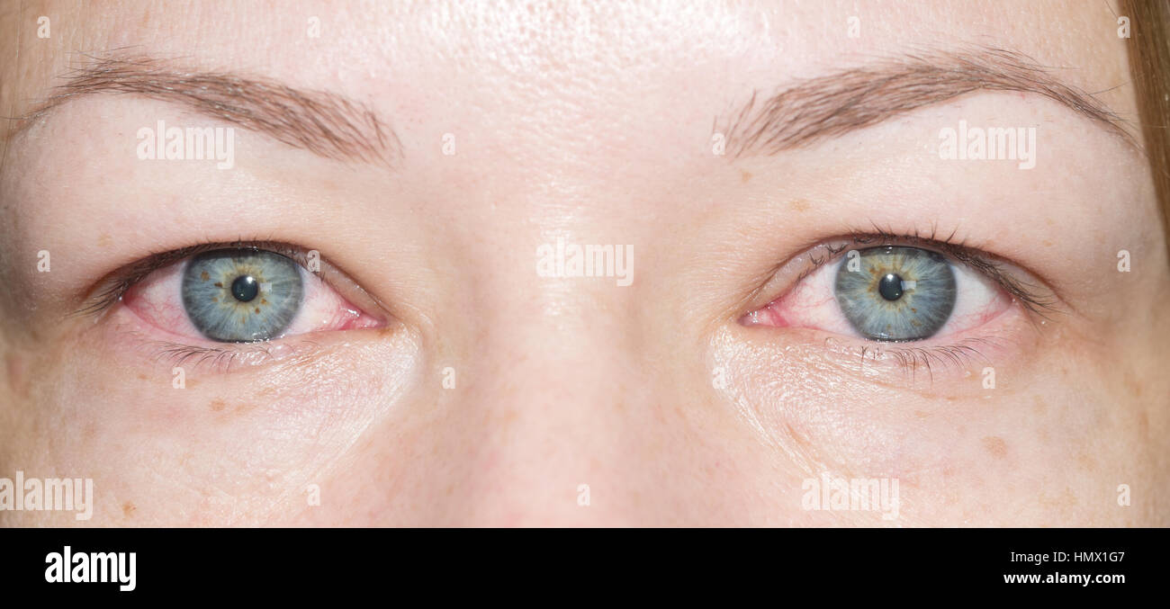 close up shot of red eyes Stock Photo - Alamy