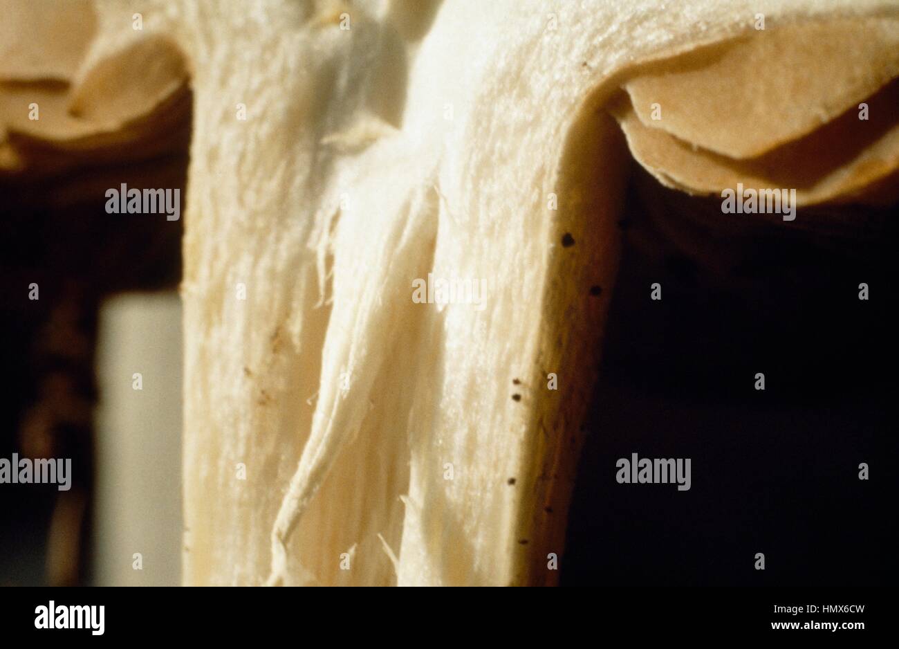 Appendix cross section hi-res stock photography and images - Alamy