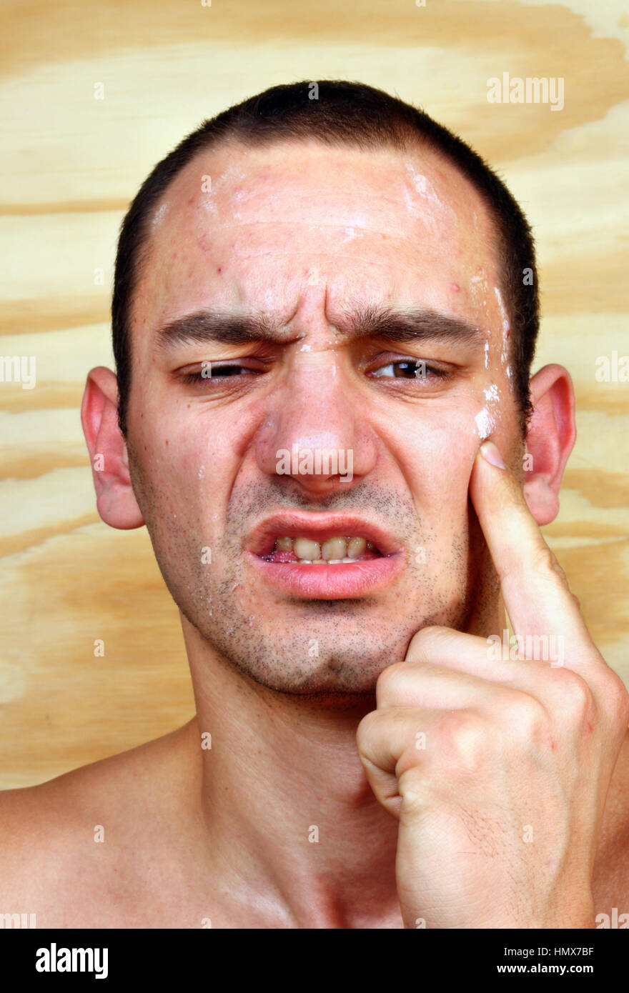 Anemia face hi-res stock photography and images - Alamy