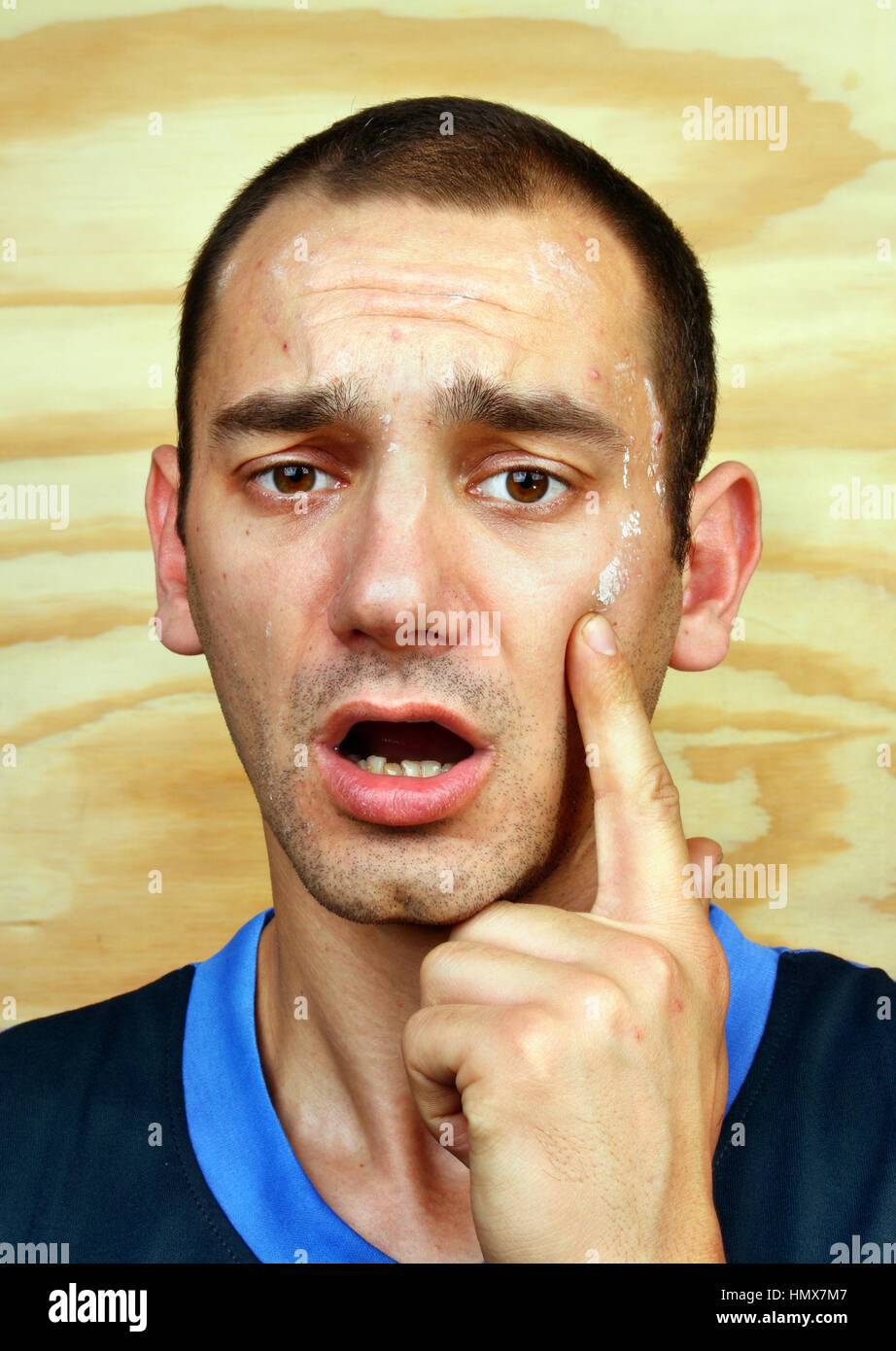 Young man with a chronic infection of the skin on the face Stock Photo ...