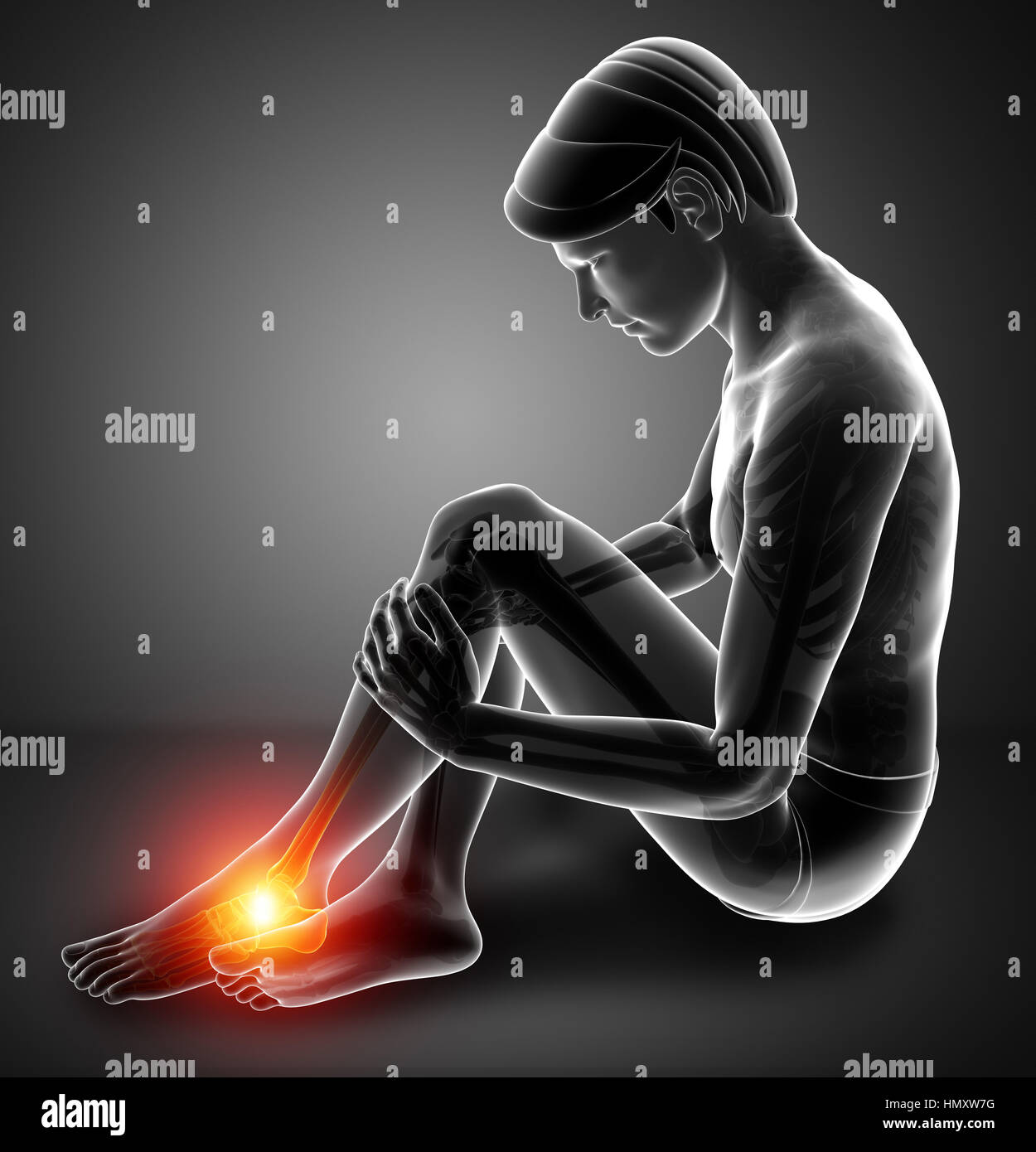 3d Illustration of Male foot with ankle pain Stock Photo - Alamy