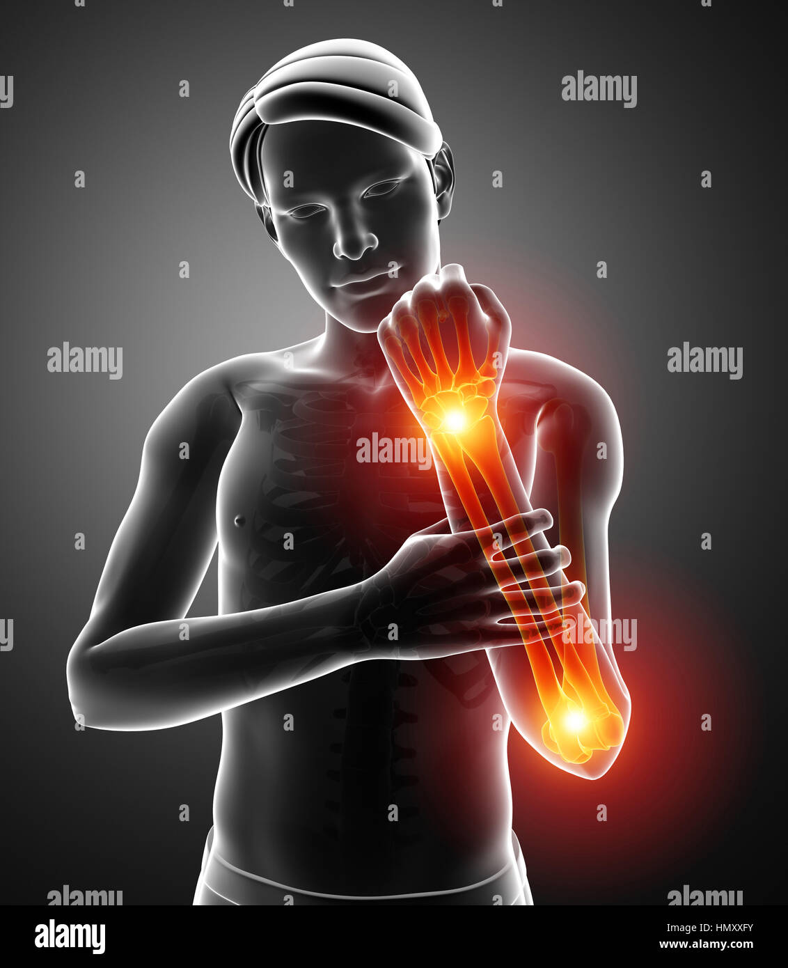 3d Illustration of Men Feeling Arm joint pain Stock Photo - Alamy