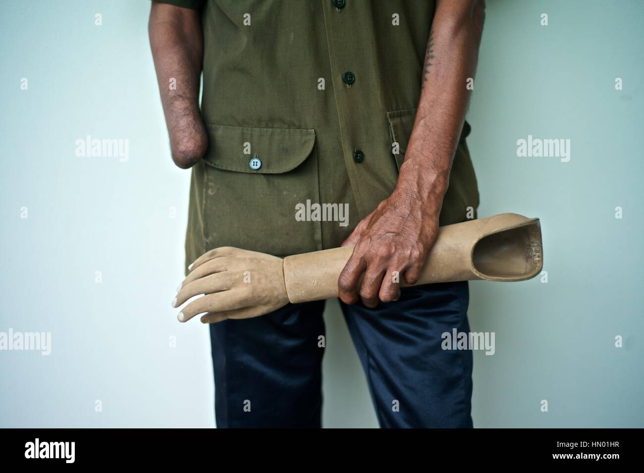 Missing limb man hi-res stock photography and images - Alamy