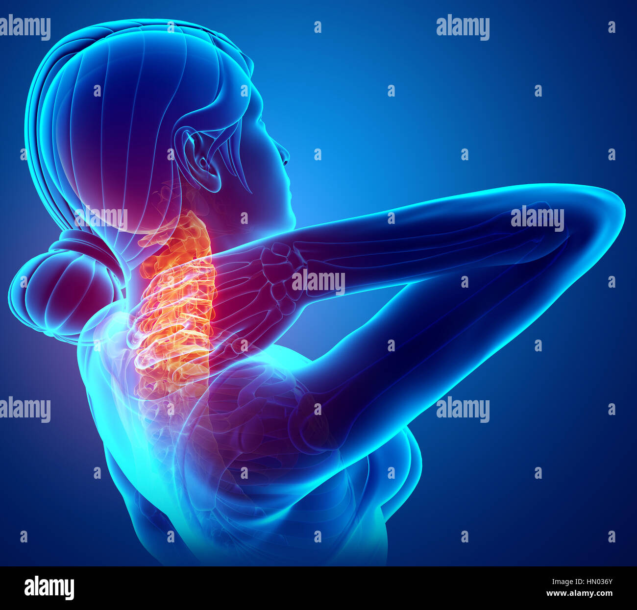 3d Illustration of Women Feeling the Neck Pain Stock Photo - Alamy
