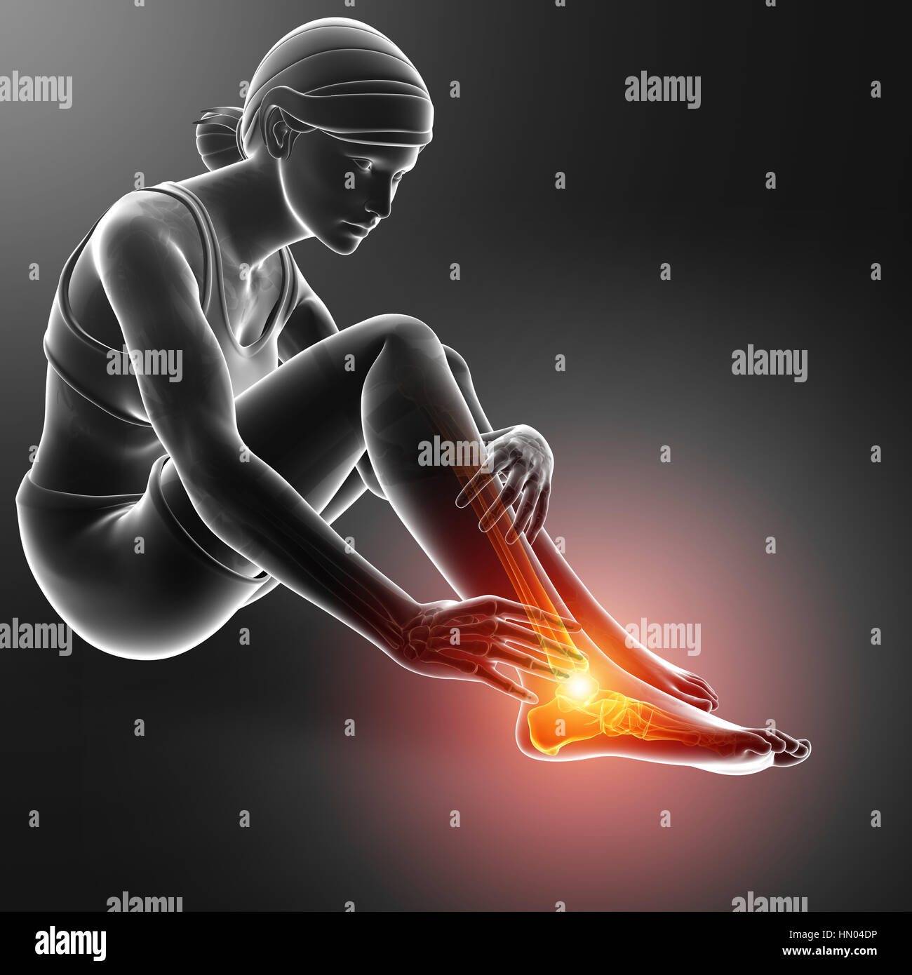 3d illustration of Female foot with ankle pain Stock Photo - Alamy