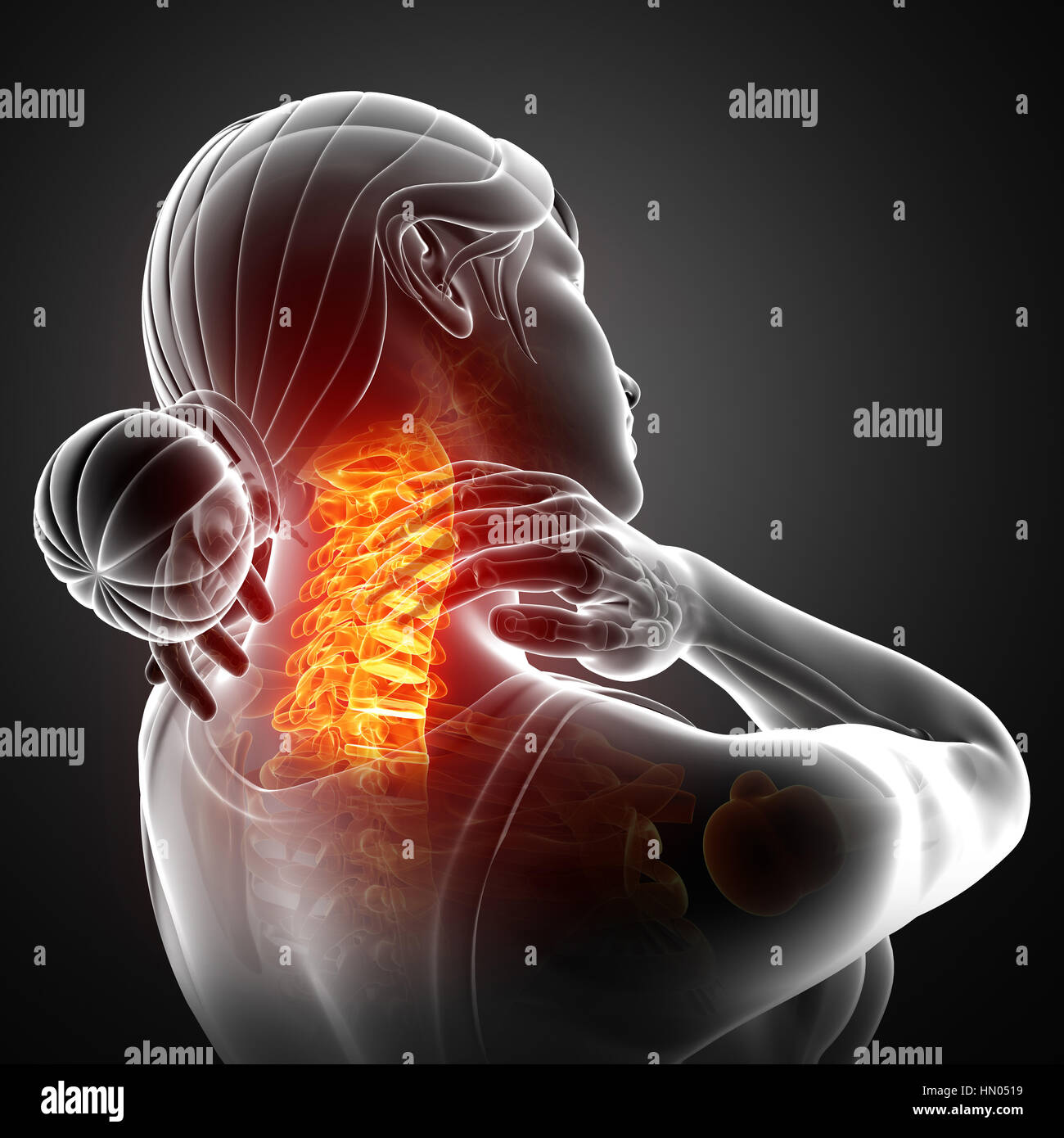 3d Illustration of Women Feeling the Neck Pain Stock Photo - Alamy