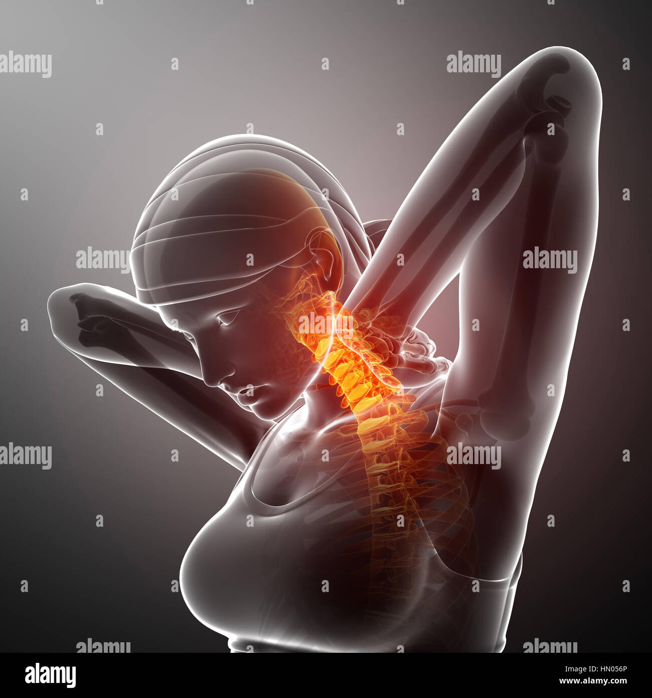3d Illustration of Women Feeling the Neck Pain Stock Photo - Alamy