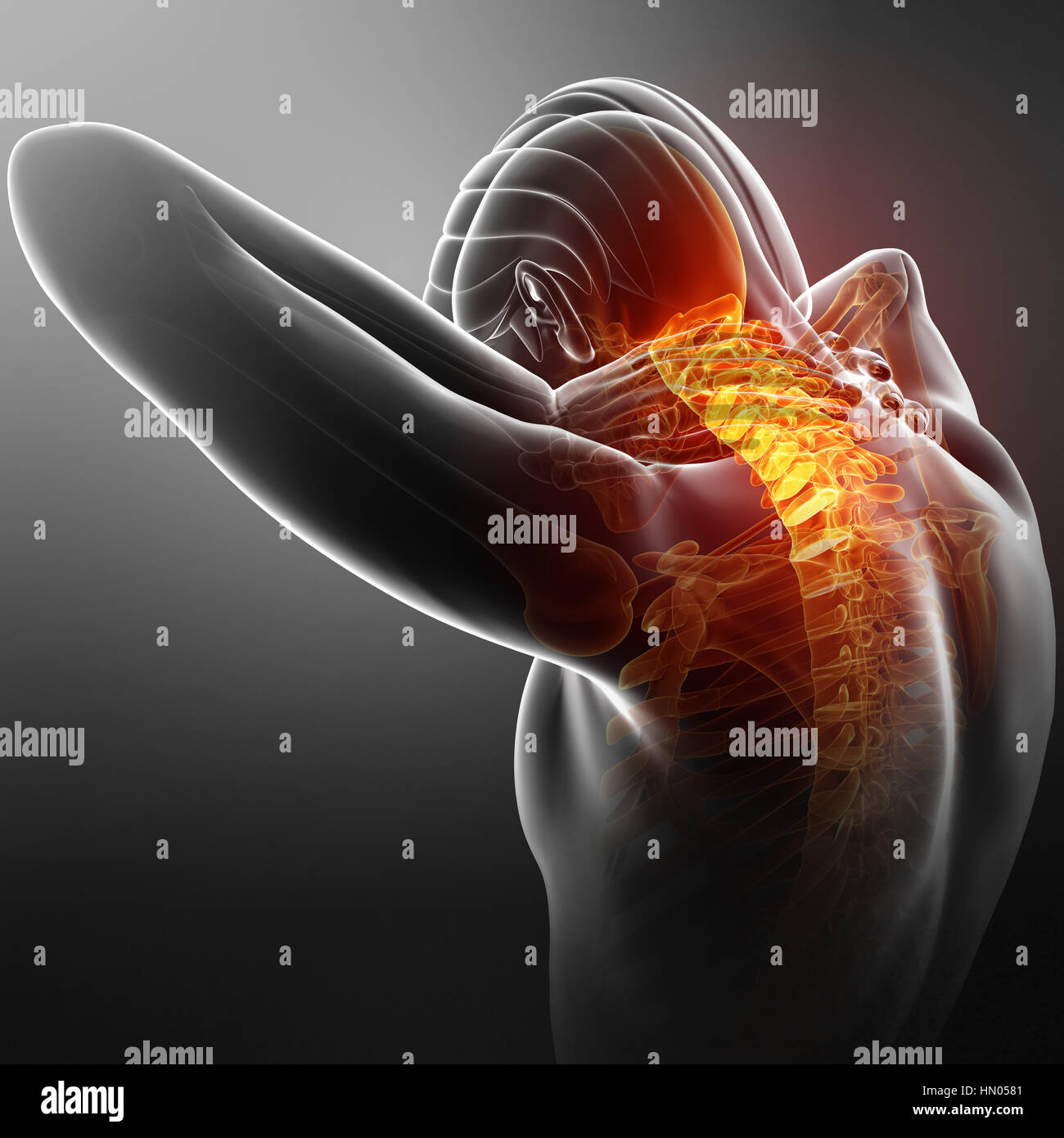 3d Illustration of men Feeling the Neck Pain Stock Photo - Alamy