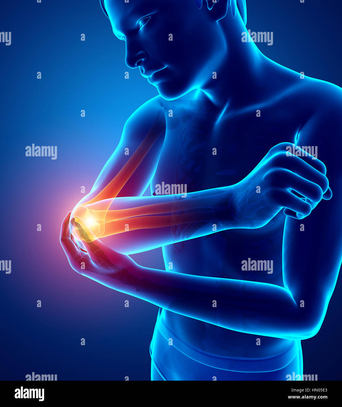 3d Illustration of Men Feeling Elbow pain Stock Photo - Alamy
