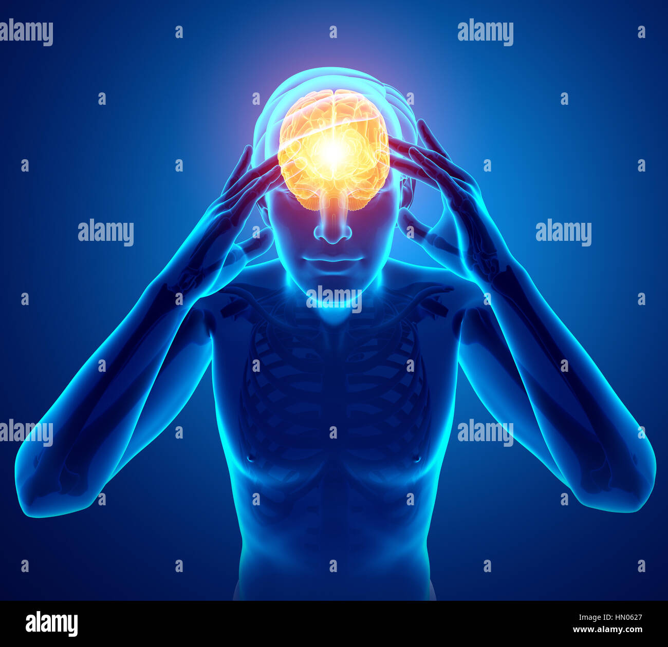 3d Illustration of Male Feeling Headache Stock Photo - Alamy