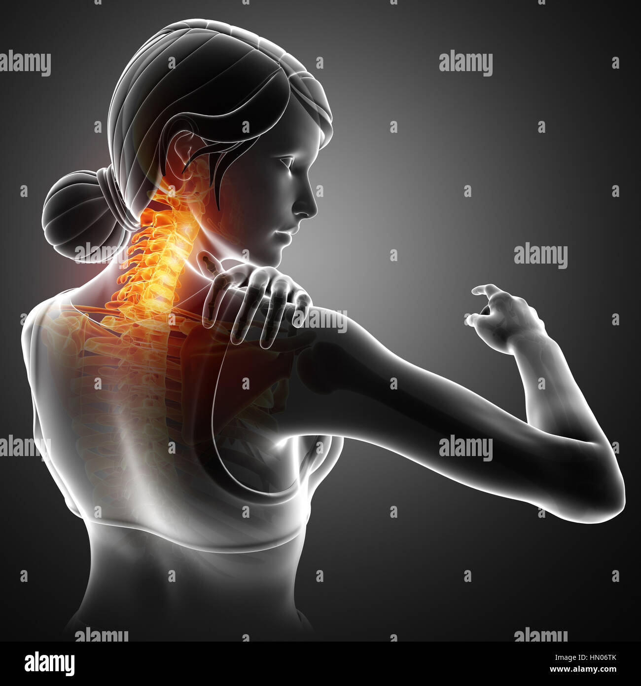 3d Illustration of Women Feeling the Neck Pain Stock Photo - Alamy