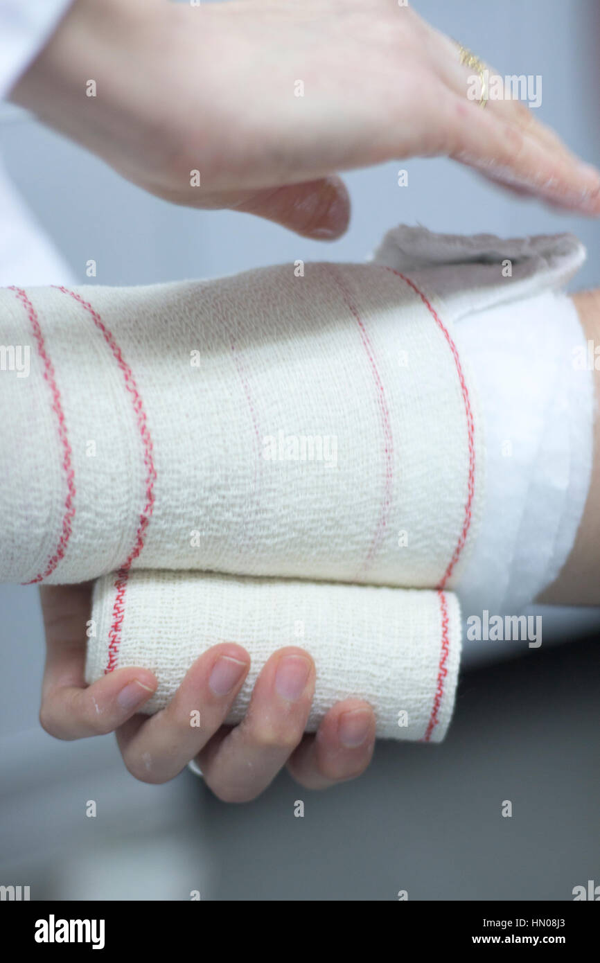Plaster after wrist fracture hi-res stock photography and images - Alamy