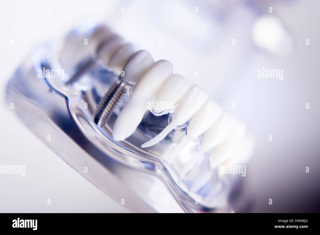Dentists tooth plastic model used for teaching, learning and patient ...