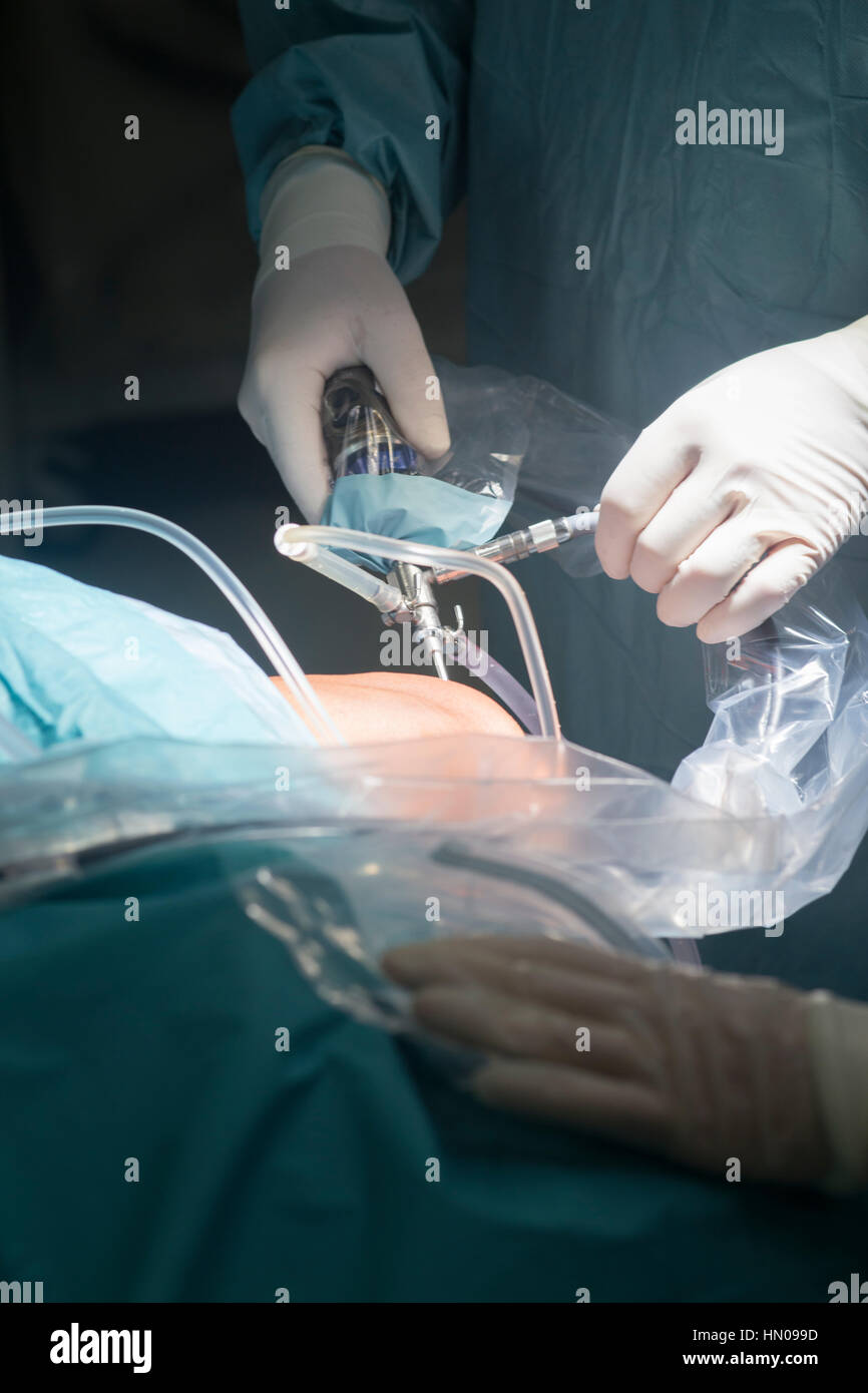 Knee keyhole surgery hospital arthroscopy operation medical procedure ...