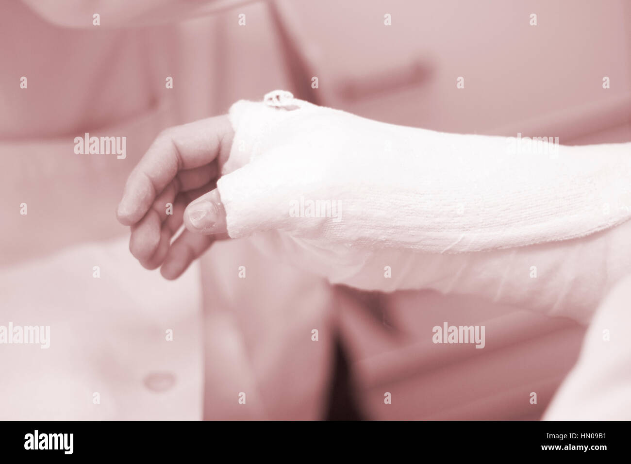 Doctor applying a plaster cast and bandages to patient forearm and ...